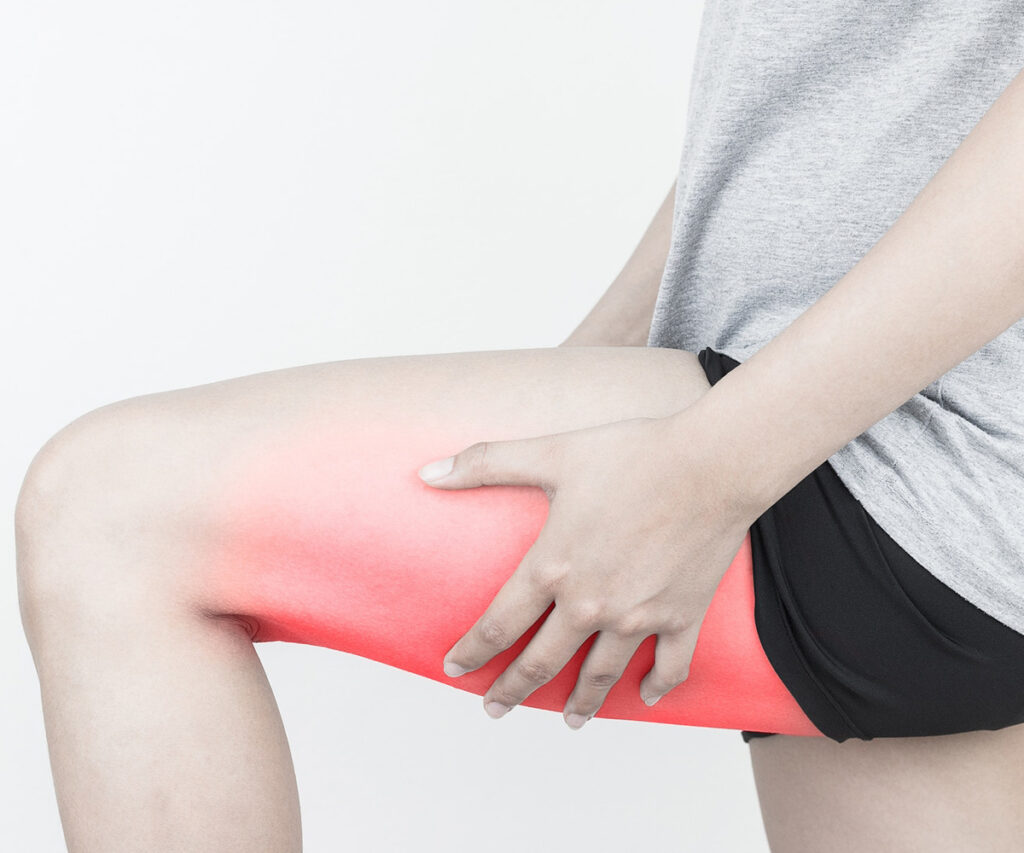 Hamstring Injuries – FunctionFit Clinics I Making Everyday Life Easier